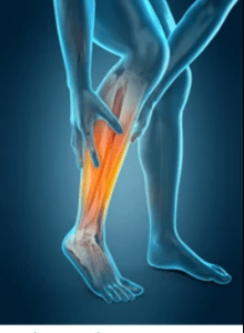 Home - MOVE Comprehensive Sports Medicine